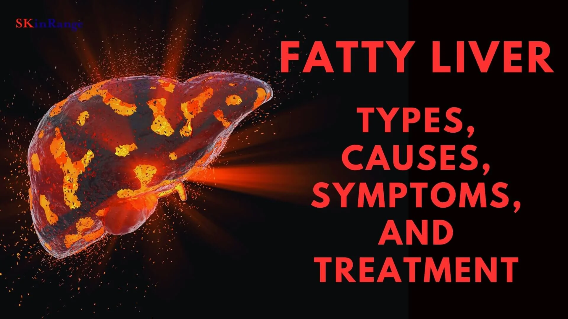 Types, symptoms, and more information about fatty liver disease